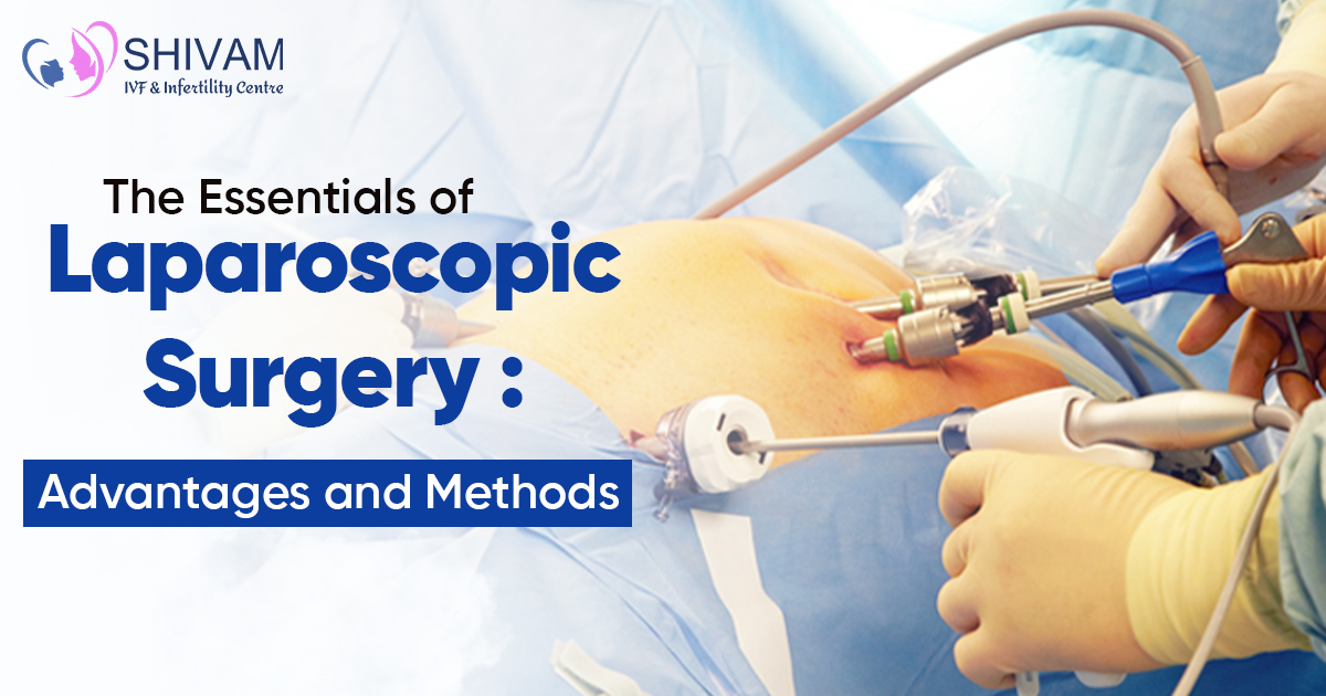 The Essentials of Laparoscopic Surgery Advantages and Methods